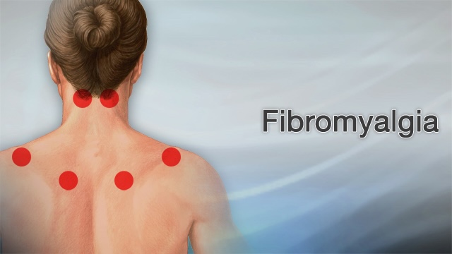 December | 2022 | FibroFighters