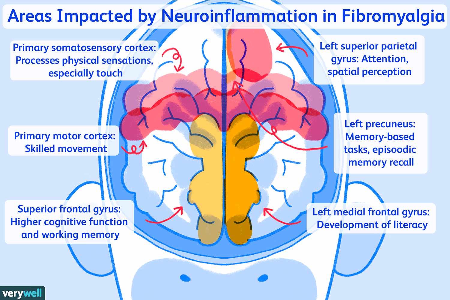 March | 2023 | FibroFighters